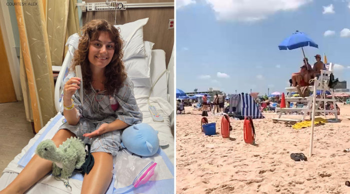 18-Year-Old Lifeguard Opens Up About Beach Umbrella Injury - TomsRiver.org
